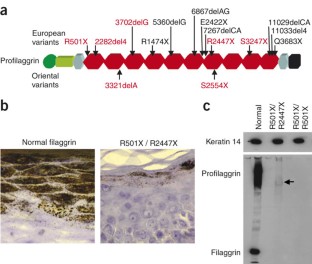 Comprehensive analysis of the gene encoding filaggrin uncovers prevalent and rare mutations in ...