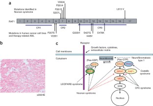 Germline gain-of-function mutations in RAF1 cause Noonan syndrome | Nature Genetics