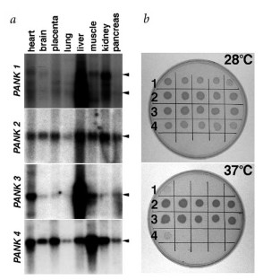 A novel pantothenate kinase gene ( PANK2 ) is defective in Hallervorden ...