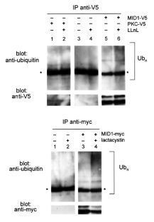 MID1 , mutated in Opitz syndrome, encodes an ubiquitin ligase that ...