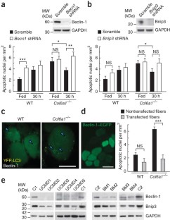 Autophagy is defective in collagen VI muscular dystrophies, and its ...