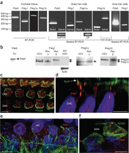 cGMP-Prkg1 signaling and Pde5 inhibition shelter cochlear hair cells ...
