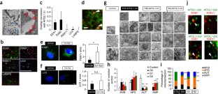Transgenic expression of human APOL1 risk variants in podocytes induces ...