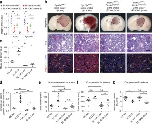 Gpr124 is essential for blood–brain barrier integrity in central ...