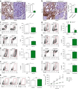 Dectin 1 activation on macrophages by galectin 9 promotes pancreatic ...