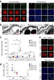 A tripartite complex of suPAR, APOL1 risk variants and α v β 3 integrin ...