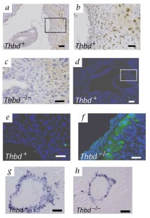 The thrombomodulin–protein C system is essential for the maintenance of ...