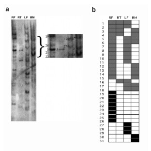 Rapid myeloerythroid repopulation after intrafemoral transplantation of ...
