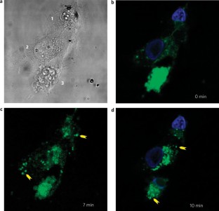 Biofunctionalized magnetic-vortex microdiscs for targeted cancer-cell ...