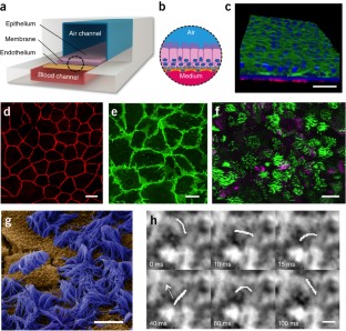 Small airway-on-a-chip enables analysis of human lung inflammation and ...