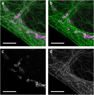 Multi-target spectrally resolved fluorescence lifetime imaging ...