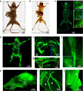 Shrinkage-mediated imaging of entire organs and organisms using uDISCO ...