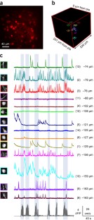 Random-access scanning microscopy for 3D imaging in awake behaving ...