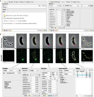 MicrobeJ, a tool for high throughput bacterial cell detection and ...