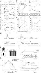Pikachurin, a dystroglycan ligand, is essential for photoreceptor ...
