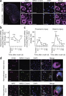 A role for Schwann cell–derived neuregulin-1 in remyelination | Nature ...