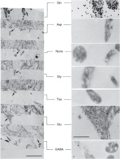 Immunogold cytochemistry in neuroscience | Nature Neuroscience