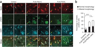 Interaction of FUS and HDAC1 regulates DNA damage response and repair ...