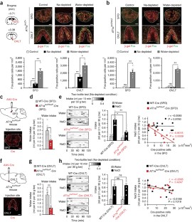 Distinct neural mechanisms for the control of thirst and salt appetite ...