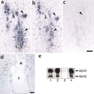 Extracellular amyloid formation and associated pathology in neural ...