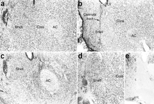 Differential control over cocaine-seeking behavior by nucleus accumbens ...