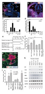 Directed differentiation of telencephalic precursors from embryonic ...