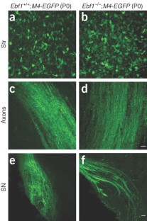 FACS-array profiling of striatal projection neuron subtypes in juvenile ...