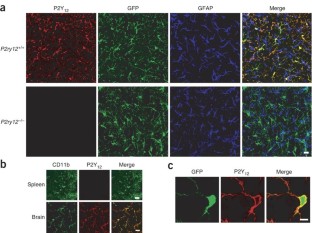The P2Y 12 receptor regulates microglial activation by extracellular ...