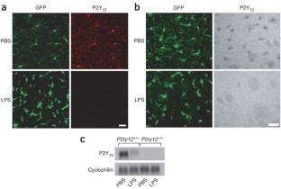 The P2Y 12 receptor regulates microglial activation by extracellular ...