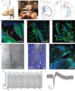 Syringe-injectable electronics | Nature Nanotechnology
