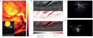 Advances in real-time multispectral optoacoustic imaging and its ...