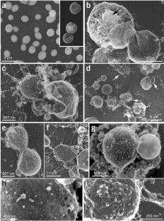 A protocol for isolation and visualization of yeast nuclei by scanning ...