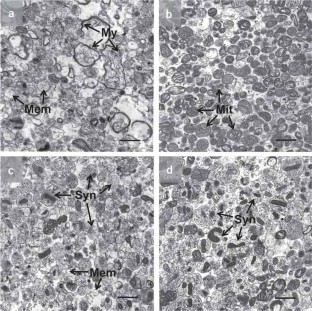 A rapid Percoll gradient procedure for preparation of synaptosomes ...