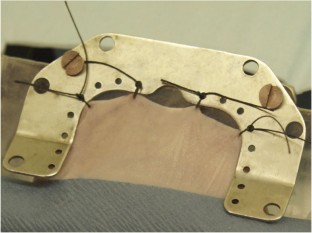 In vivo optical molecular imaging and analysis in mice using dorsal ...