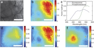 In vivo optical molecular imaging and analysis in mice using dorsal ...