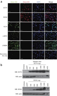 Reprogramming human fibroblasts to pluripotency using modified mRNA ...