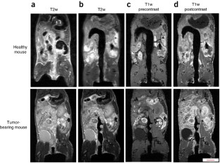 In vivo MRI virtual colonography in a mouse model of colon cancer ...