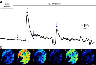 Using pancreas tissue slices for in situ studies of islet of Langerhans ...