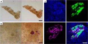 Using pancreas tissue slices for in situ studies of islet of Langerhans ...