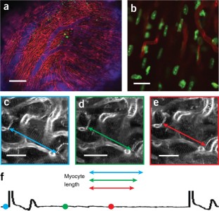 Imaging the beating heart in the mouse using intravital microscopy ...