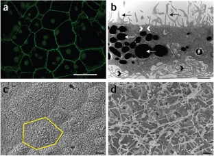 Isolation, culture and characterization of primary mouse RPE cells ...