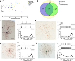 Multimodal profiling of single-cell morphology, electrophysiology, and ...