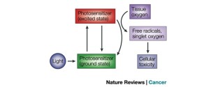 Photodynamic therapy for cancer | Nature Reviews Cancer