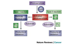Photodynamic therapy for cancer | Nature Reviews Cancer