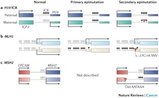 Constitutional epimutation as a mechanism for cancer causality and ...