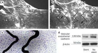 The importance of the endothelium in atherothrombosis and coronary ...