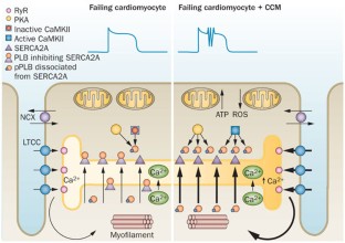 Cardiac contractility modulation therapy in advanced systolic heart ...