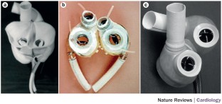 Total artificial hearts: past, present, and future | Nature Reviews ...