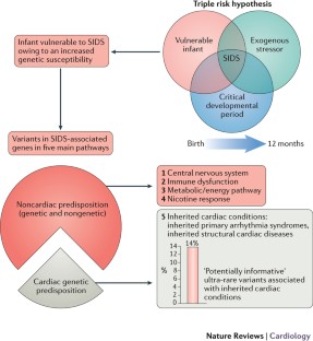 Sudden infant death syndrome and inherited cardiac conditions | Nature ...