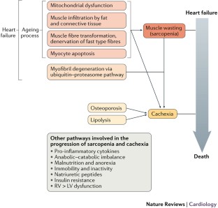 Muscle wasting and cachexia in heart failure: mechanisms and therapies ...